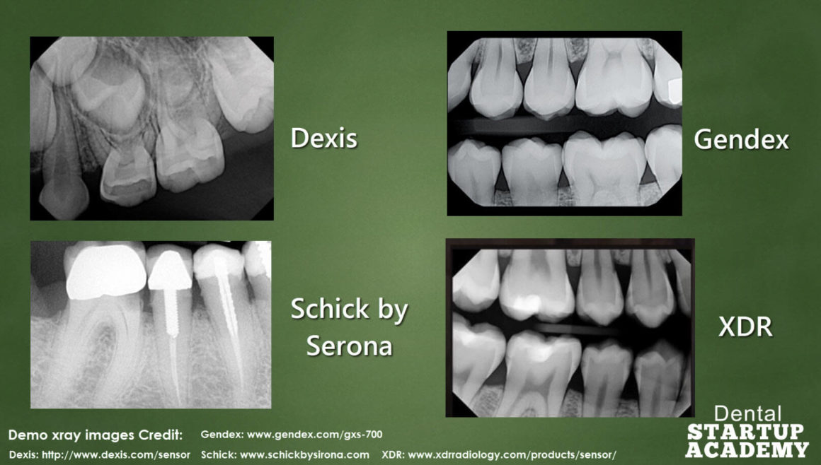 5 factors to consider before buying a Dental Xray Sensor